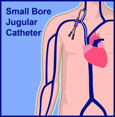 Central Venous Catheter Lines | Vascular Wellness