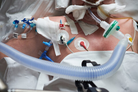 What are the potential complications of a Central Line? | Vascular Wellness