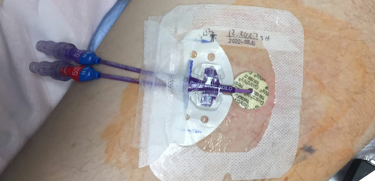 PICC Line and Midline Catheter Care | Vascular Wellness