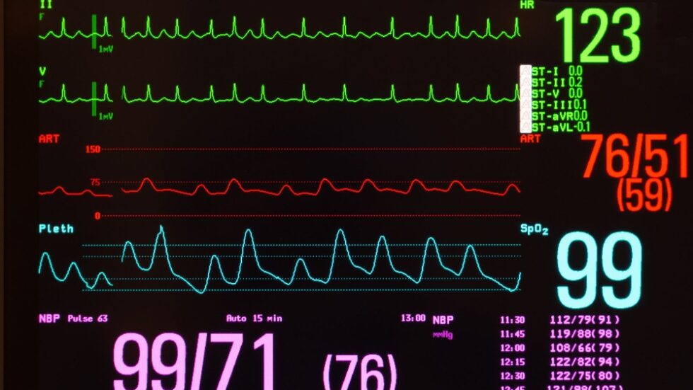 Arterial Lines | Vascular Wellness