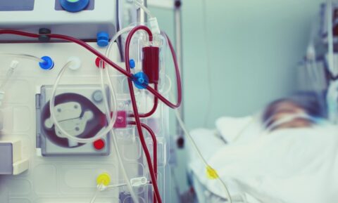 Tunneled Central Lines | Vascular Wellness