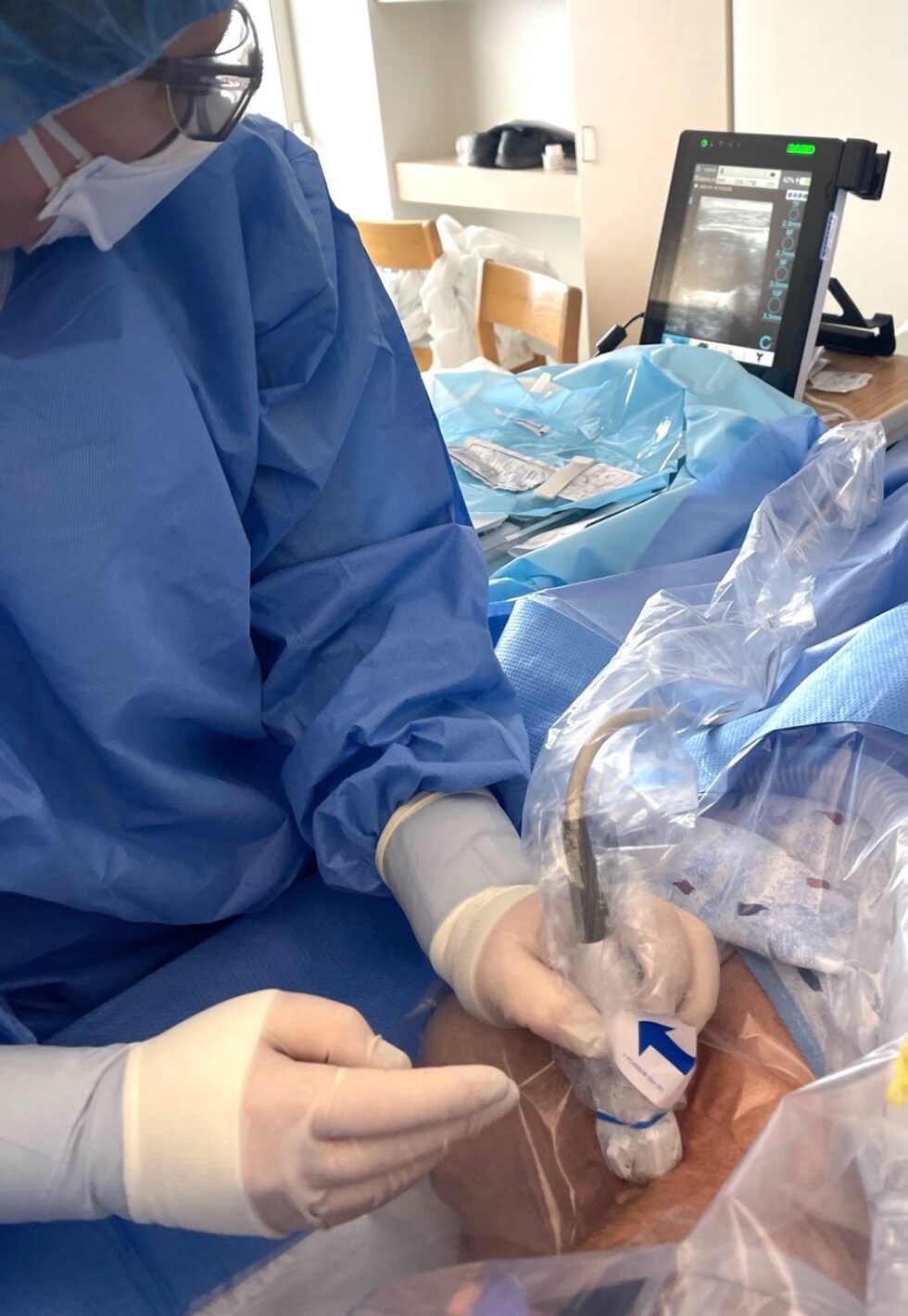 Tunneled Central Lines | Vascular Wellness