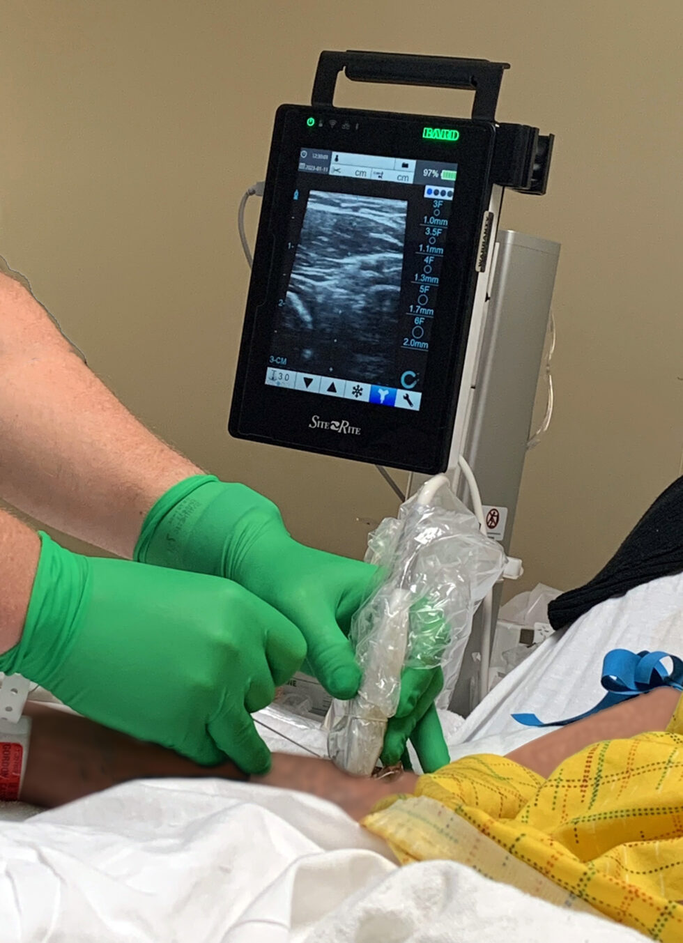 IV Access Services | Vascular Wellness