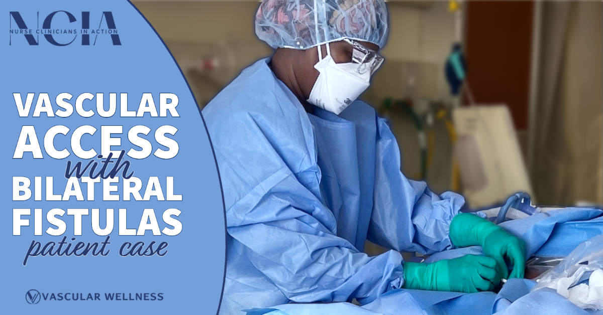 Vascular Access with Bilateral Fistulas | Vascular Wellness