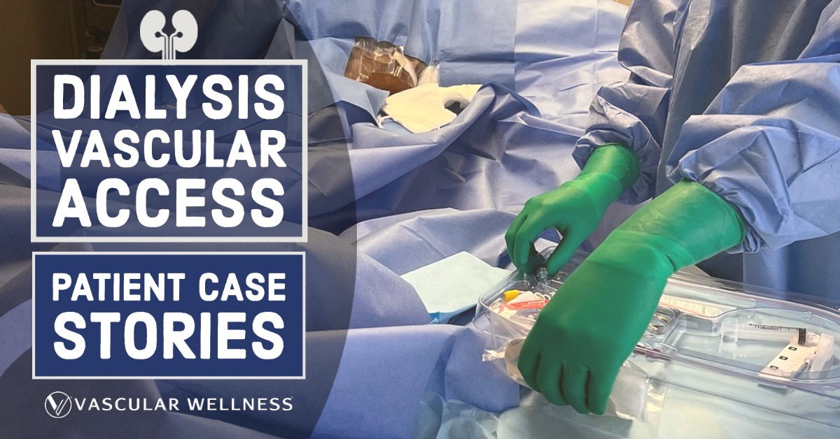 Dialysis Vascular Access Cases | Vascular Wellness