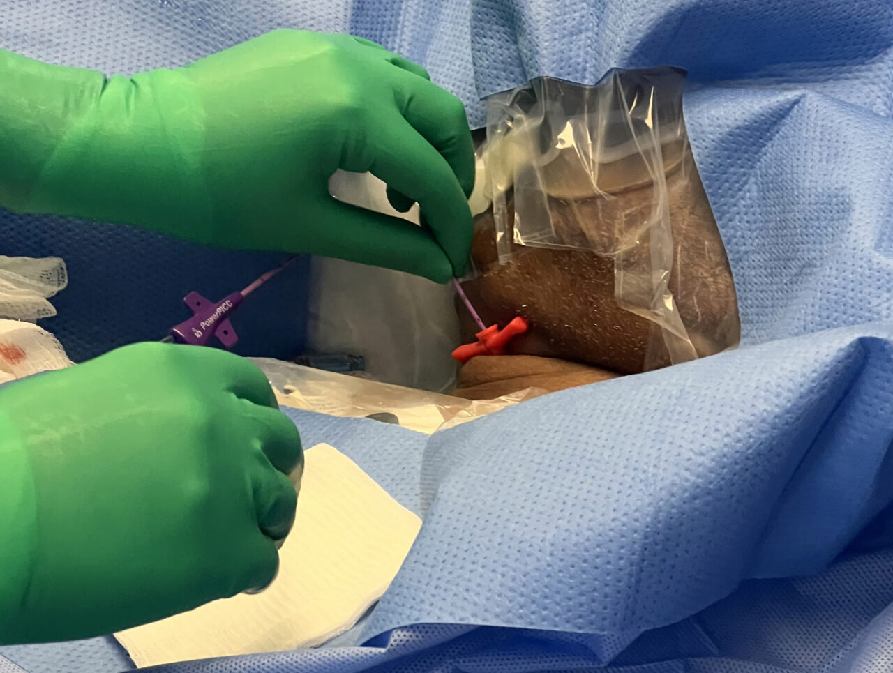 Vascular Access Patient Education | Vascular Wellness