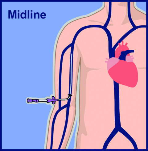Midlines | Vascular Wellness