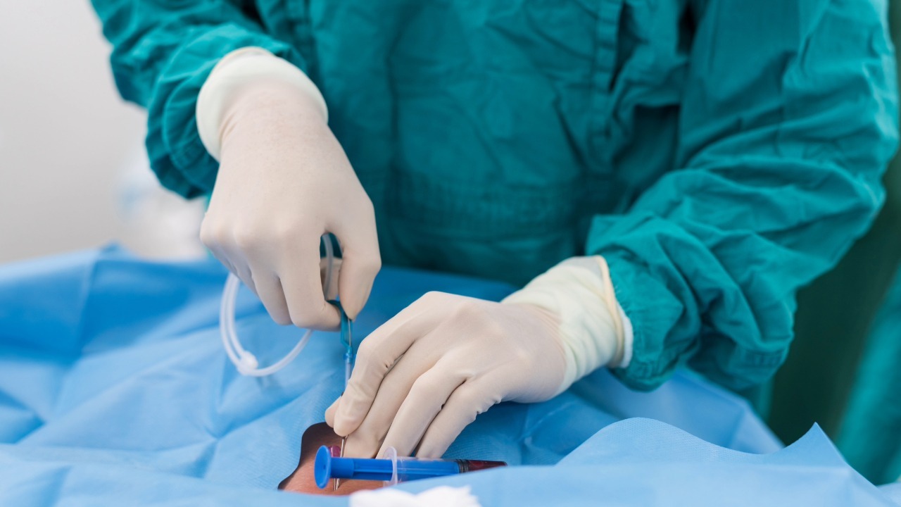 Air Embolism Causes, Prevention, and Management | Vascular Wellness