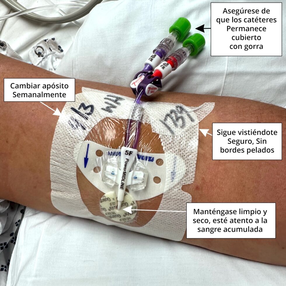 Vascular Access Patient Education | Vascular Wellness