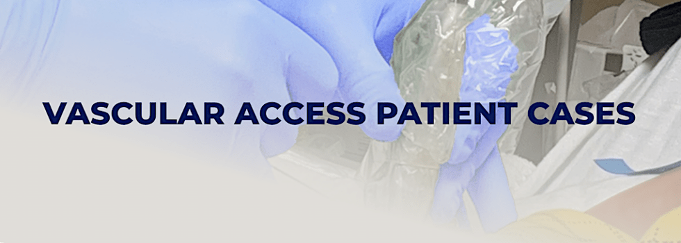 Infrared and Ultrasound for Vein Visualization | Vascular Wellness